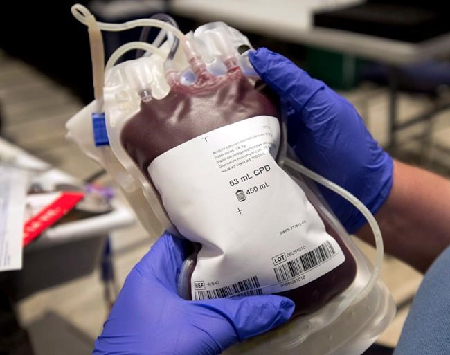 Blood donor Deferral Period For Men Who Have Sex With Men Cut To Three blood-donor-deferral-period-for-men-who-have-sex-with-men-cut-to-three