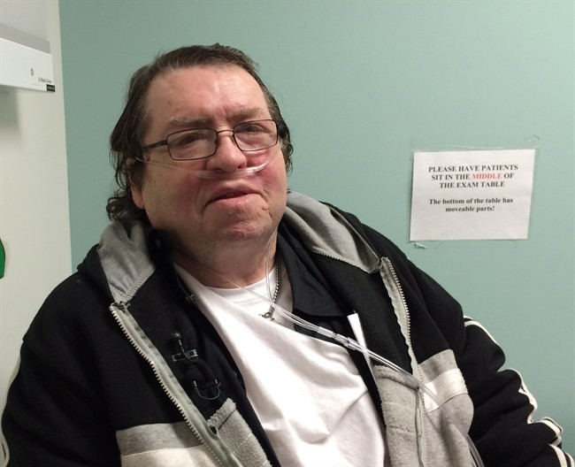 Growing number of people suffering burns from smoking while on oxygen ...