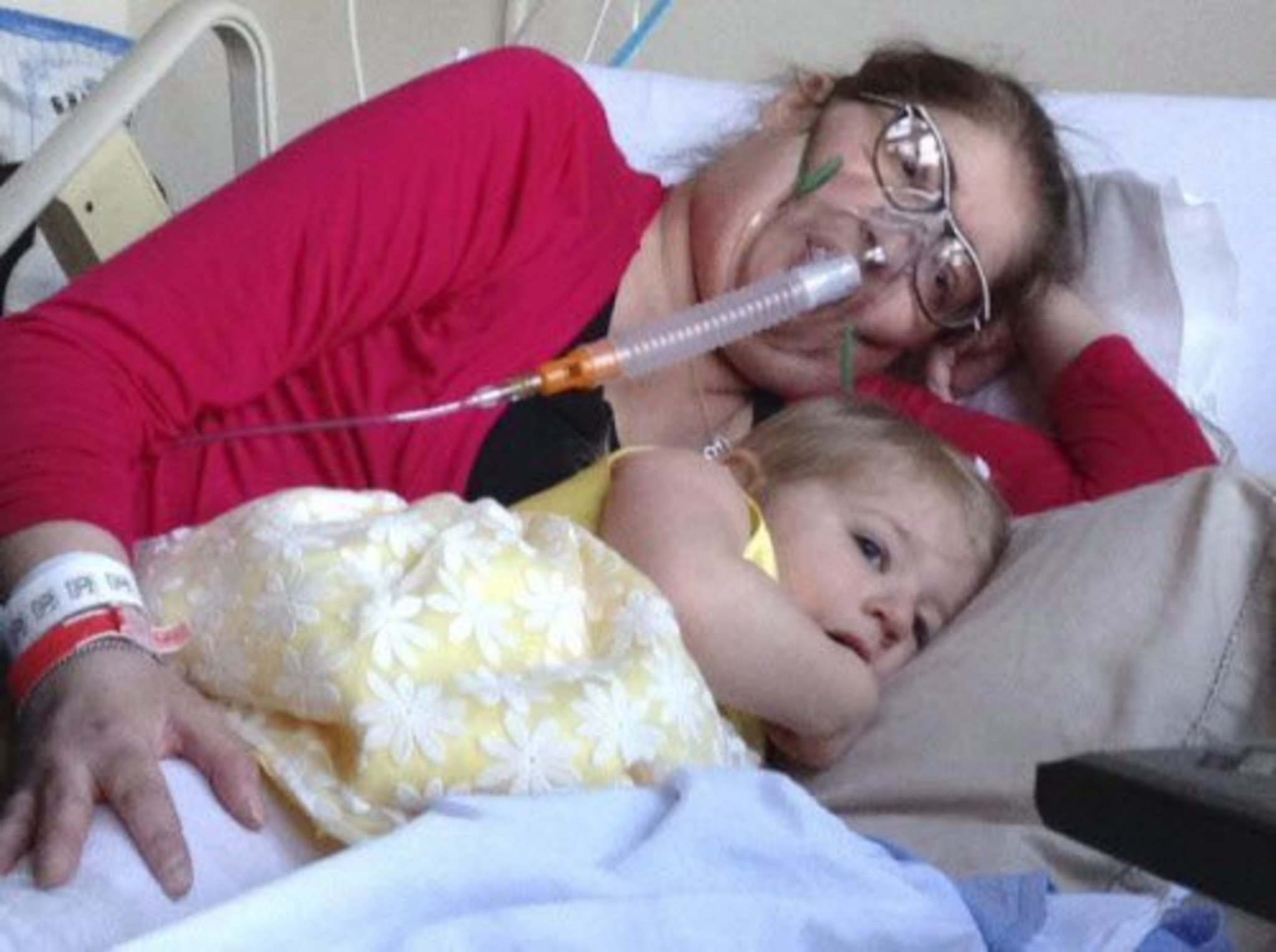 Living without lungs – Winnipeg Free Press