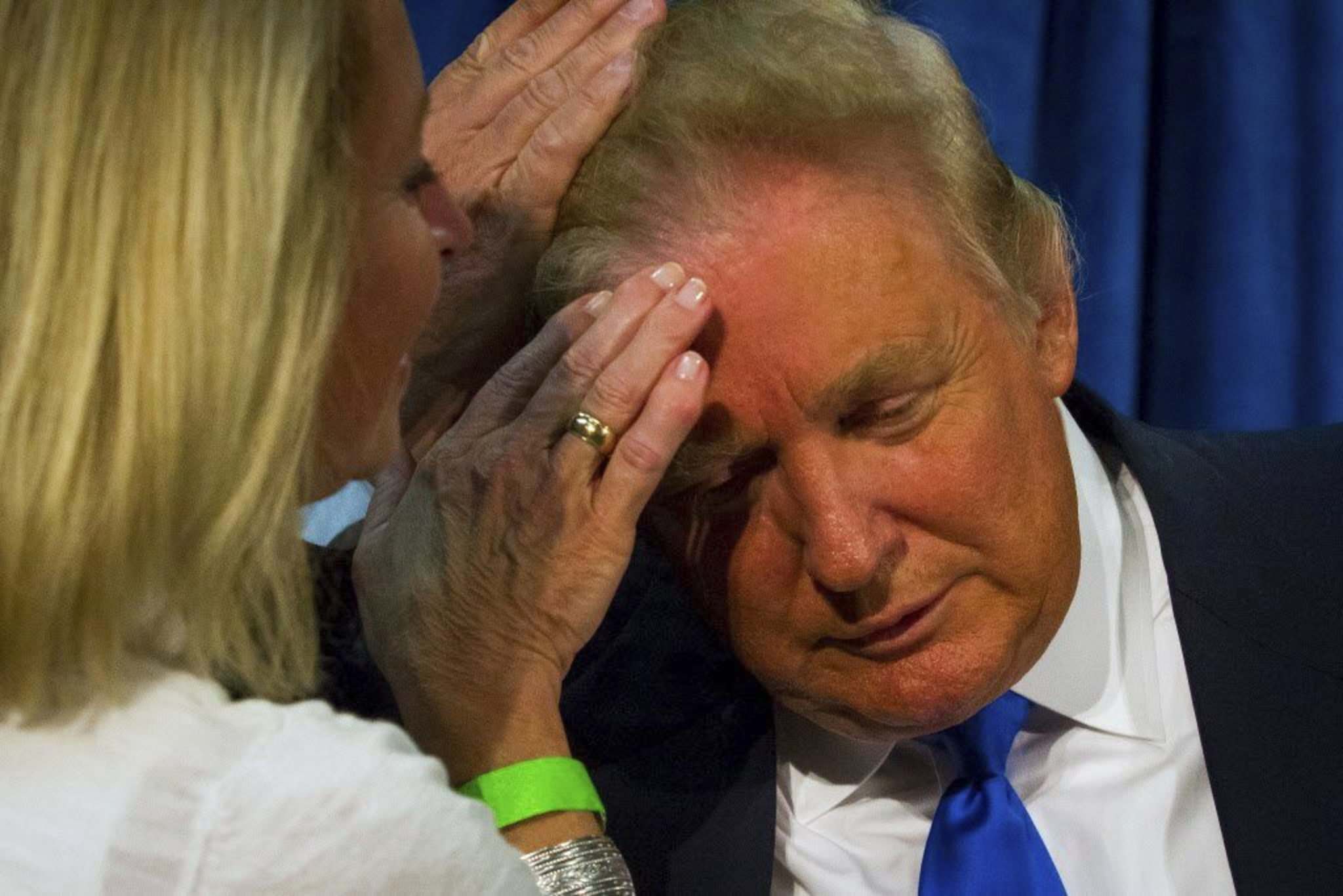 Much a ‘do about the president’s hair – Winnipeg Free Press