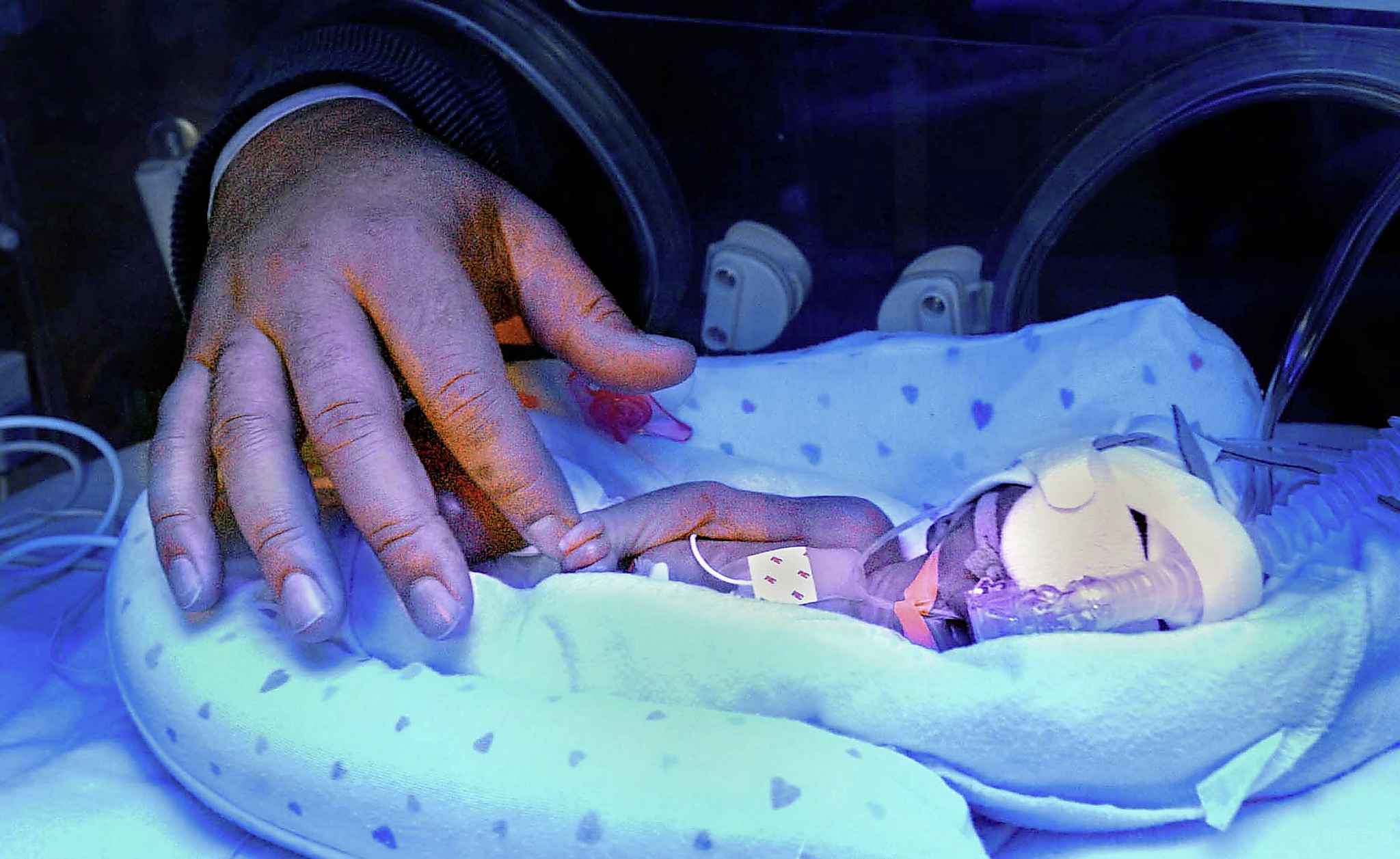 WRHA reports increase in babies born with drug addiction/withdrawal – Winnipeg Free Press