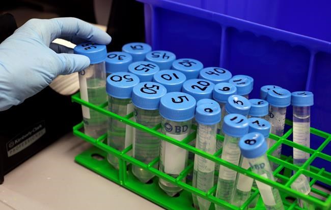 Change may allow scientists to grow human embryos longer – Winnipeg ...
