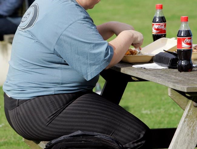 UN Obesity Levels In Europe At epidemic Proportions Winnipeg Free Press un-obesity-levels-in-europe-at-epidemic-proportions-winnipeg-free-press