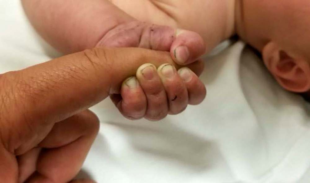 Spike in congenital syphilis births sparks call for government action ...