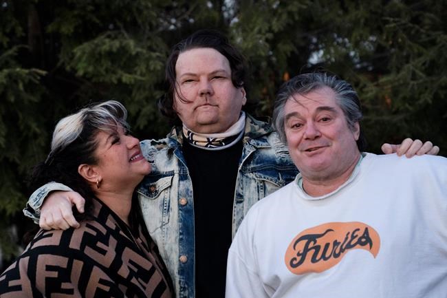 ‘New chance at life’: Man gets face, hands in rare surgery – Winnipeg ...