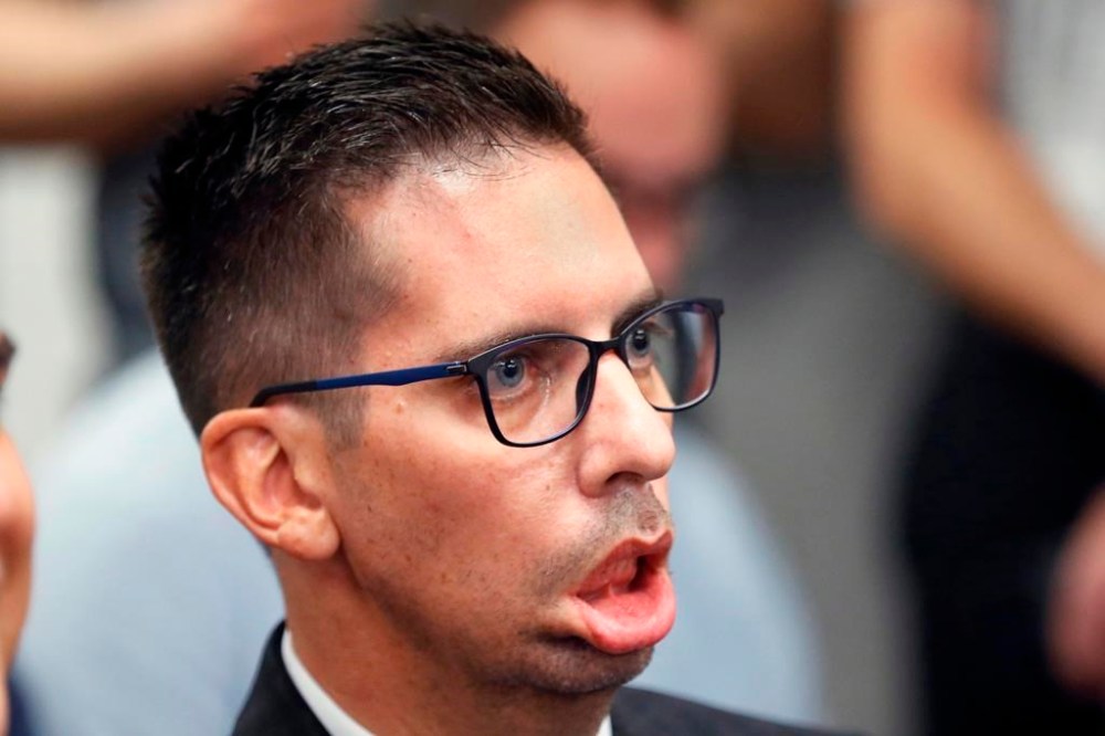 Flames vice-president Chris Snow suffers brain injury, not expected to ...