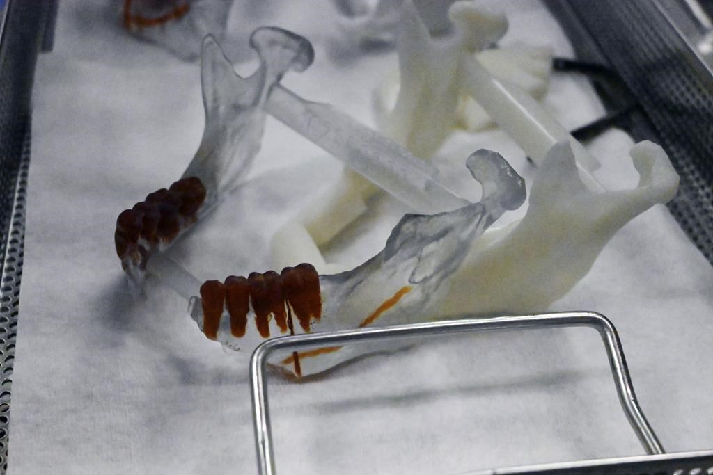 Montana man to return home from hospital weeks after grizzly bear bit ...