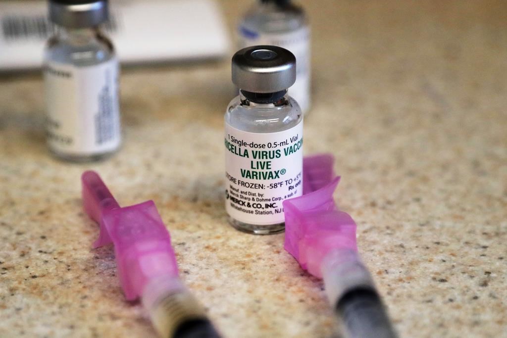 UK experts recommend chickenpox shot for kids for the first time ...