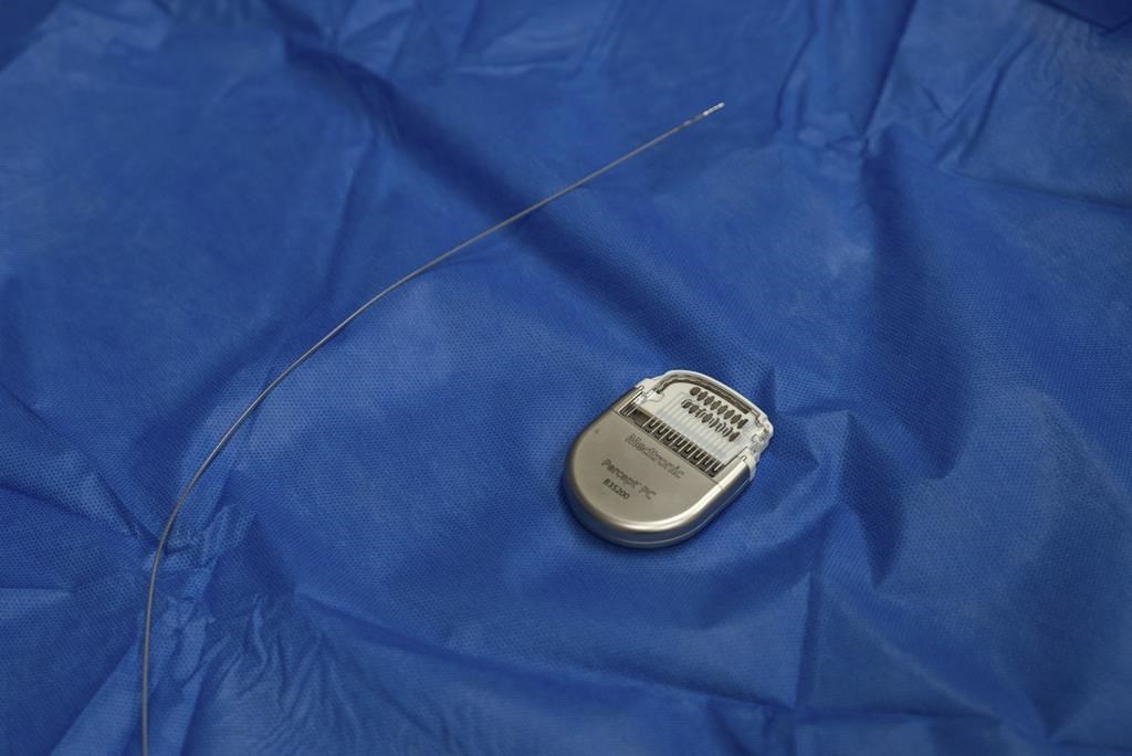 A brain pacemaker helped a woman with crippling depression. It may soon ...