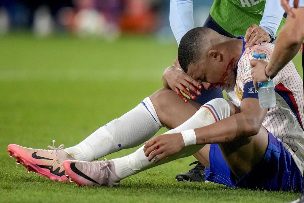 Kylian Mbappé due for tests on his broken nose as France gets ‘positive ...