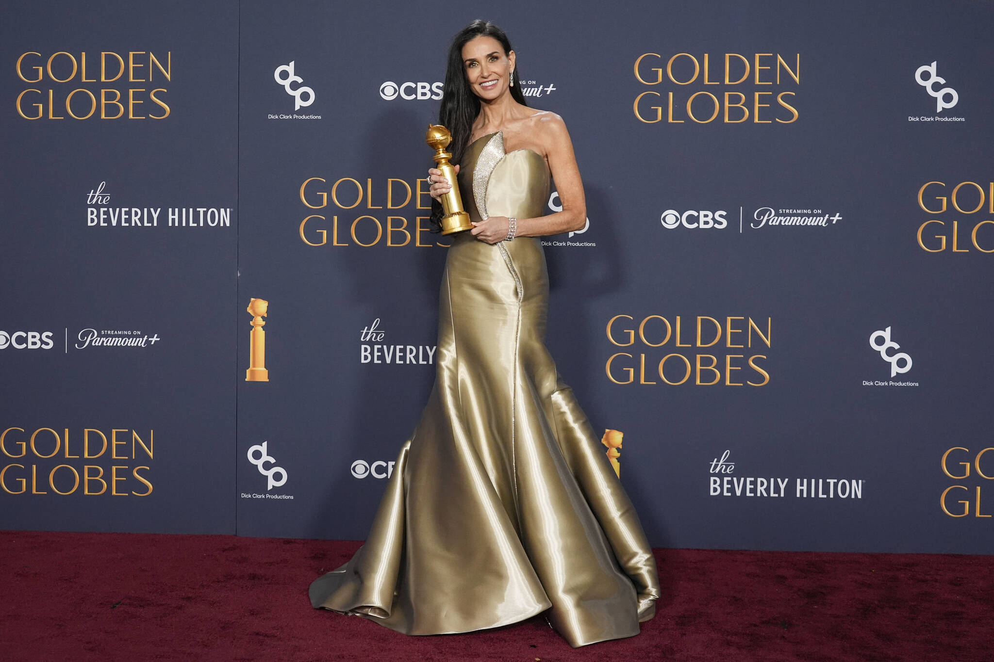 The toll of Tinseltown’s unattainable standards – Winnipeg Free Press