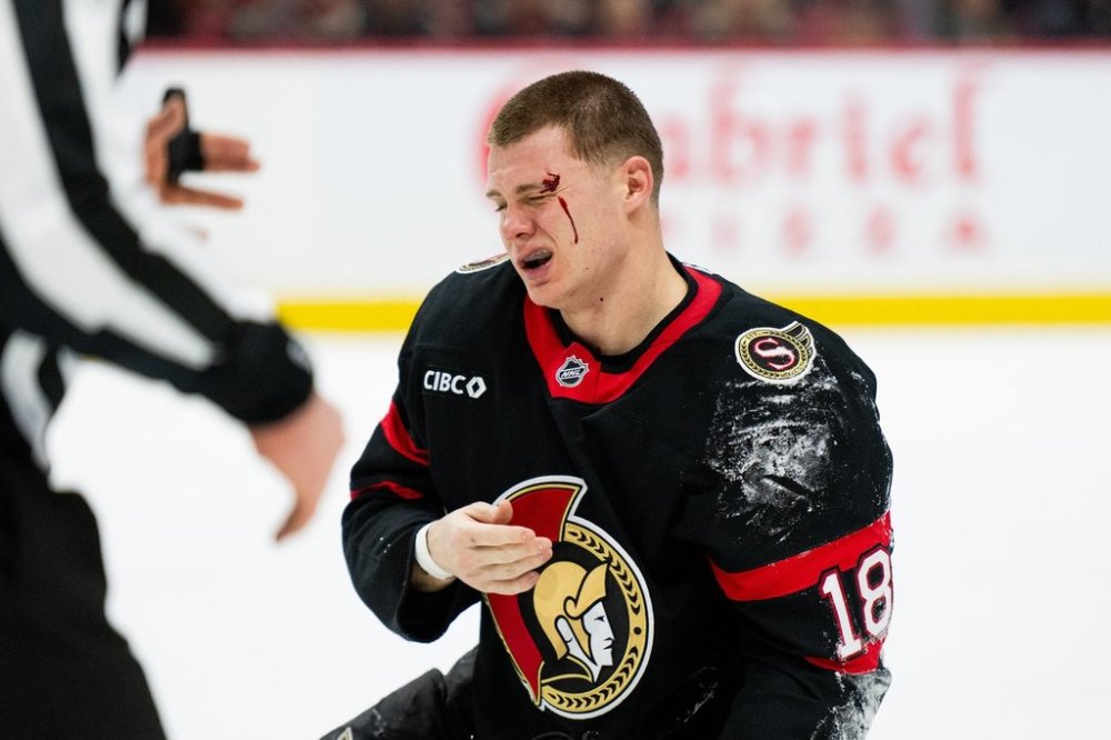 Senators send Wild a powerful message after hit on Stutzle – Winnipeg ...