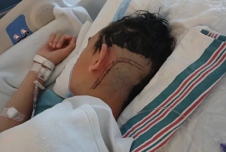 Man pleads guilty to unprovoked baseball bat attack on Ukrainian ...